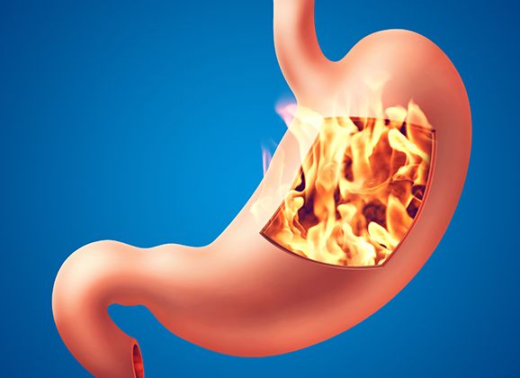 Maagzuurremmers - kPNI Huis